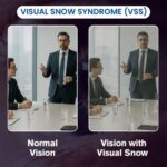 Visual Snow Syndrome: Causes, Symptoms, and Treatments