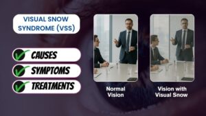Visual Snow Syndrome: Causes, Symptoms, and Treatments
